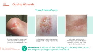 Avene Cicalfate Absorbing Soothing Spray | PPT