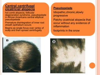 Cicatricisial alopecia | PPT