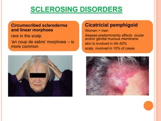 Cicatricial Pemphigoid Scalp