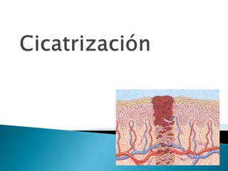 Cicatrización | PPTX