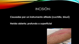 Cicatrización de heridas | PPTX