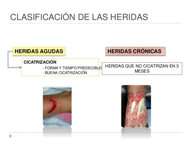 Cicatrización de heridas