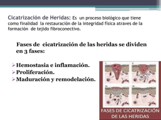 Cicatrización de Heridas.pptx