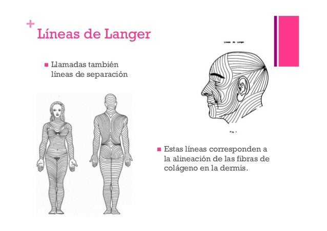 Cicatrización patológica Dante Sanchez Carrasco