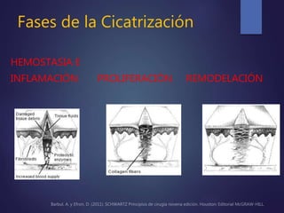 heridas y su manejo (cicatrización) | PPTX