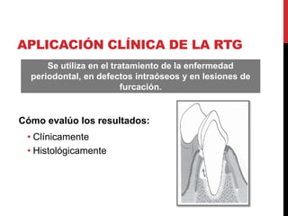 Cicatrizacion y regeneracion tisular guiada | PPTX