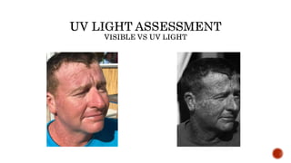 Effects of the Sun (UV Radiation) on the Skin | PPTX