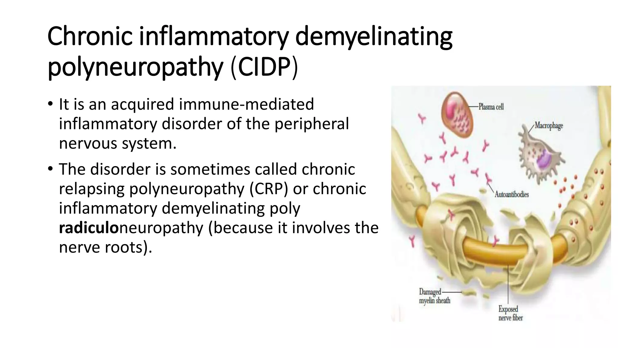 CIDP.pptx