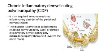 CIDP.pptx