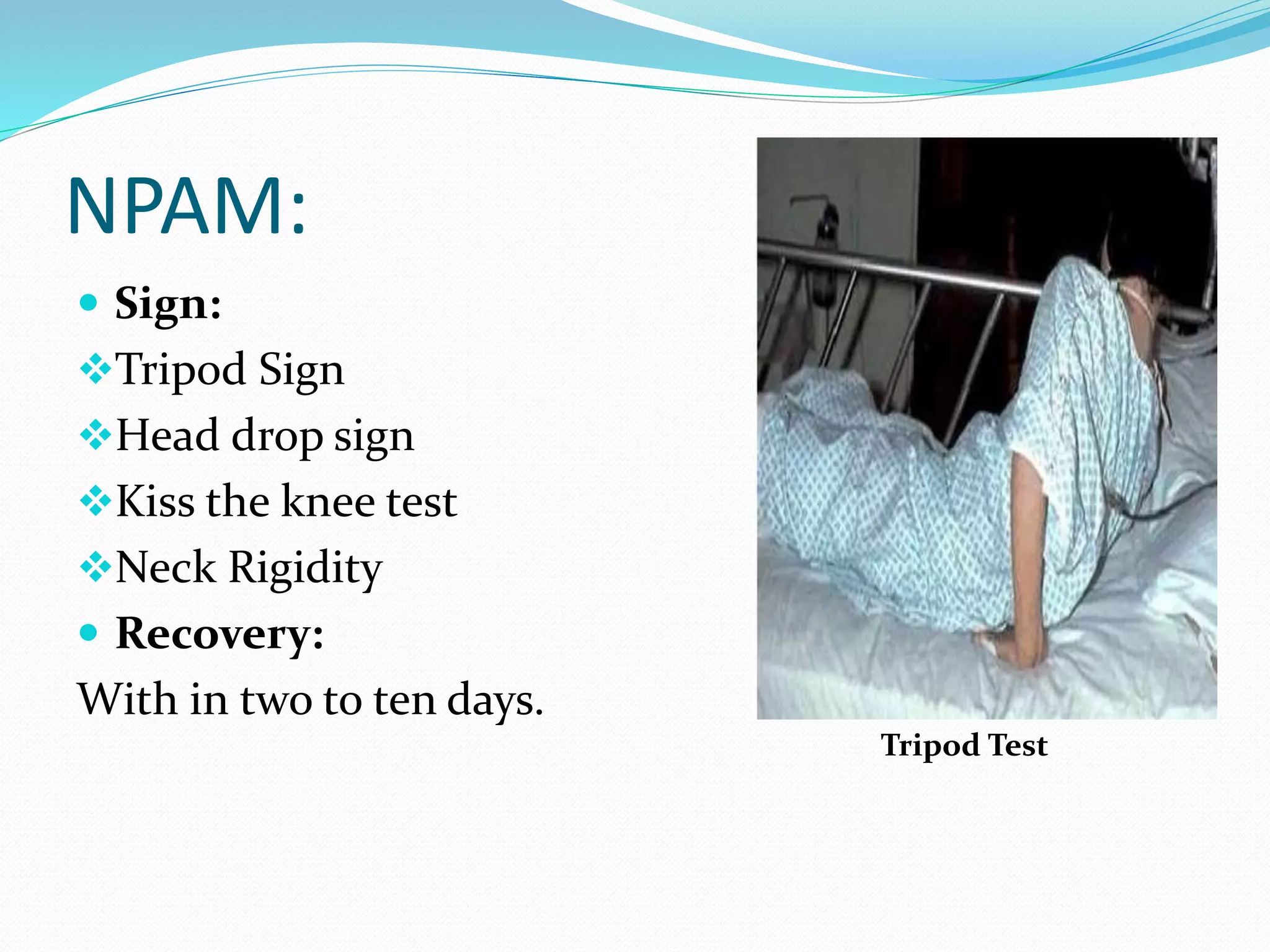 Poliomyelitis | PPTX