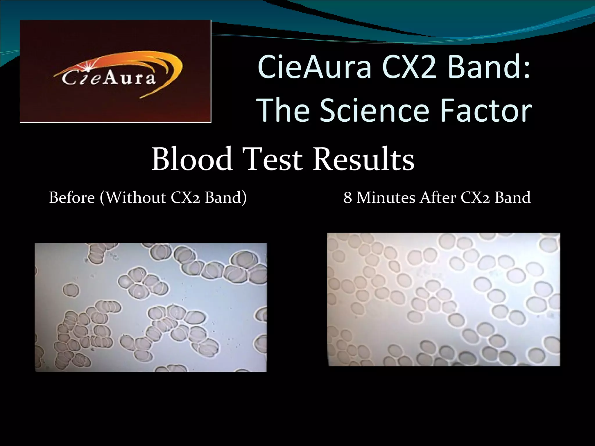 CieAura CX2 Plus Wristband | PPT