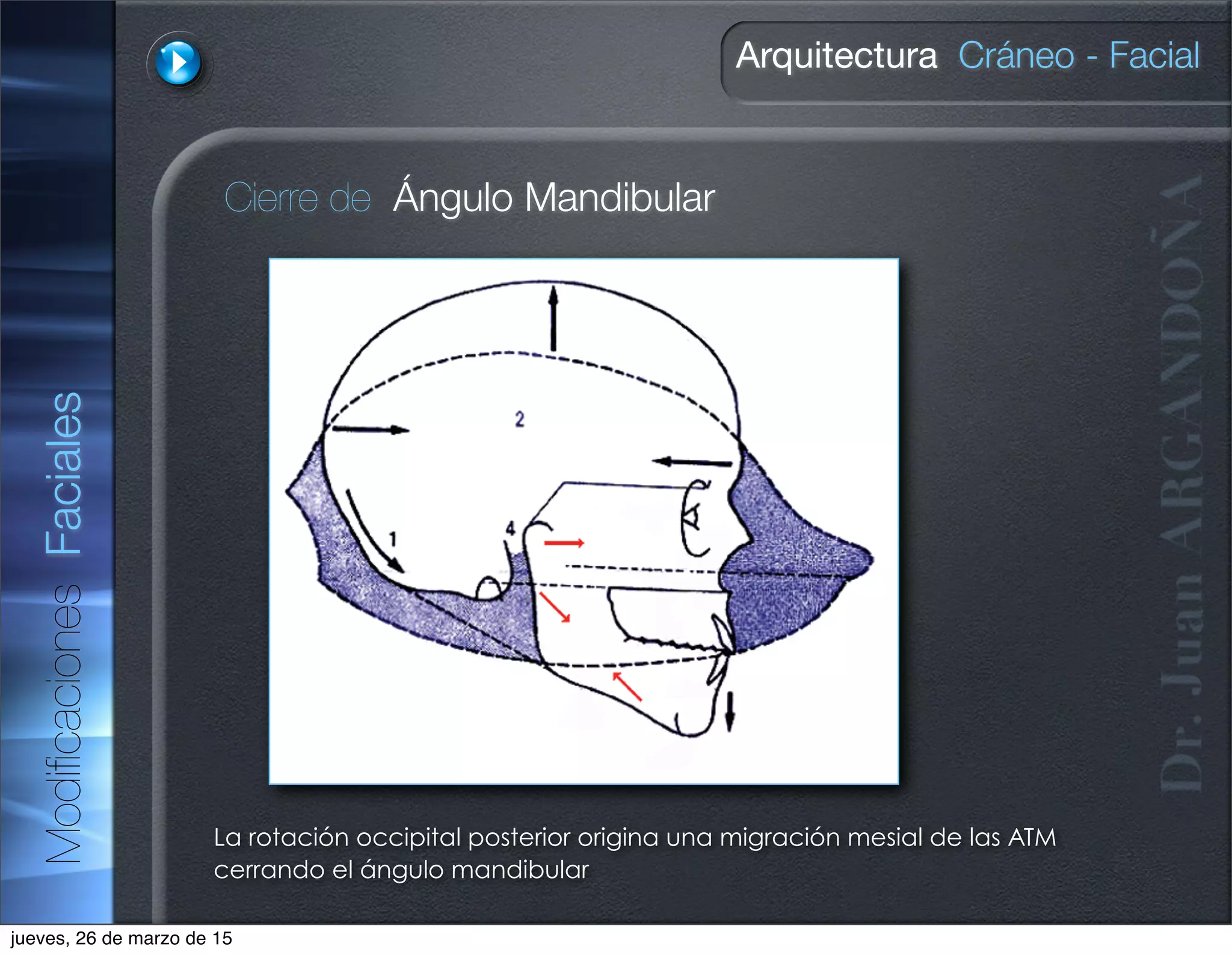 Cierre Ángulo Mandibular | PPT