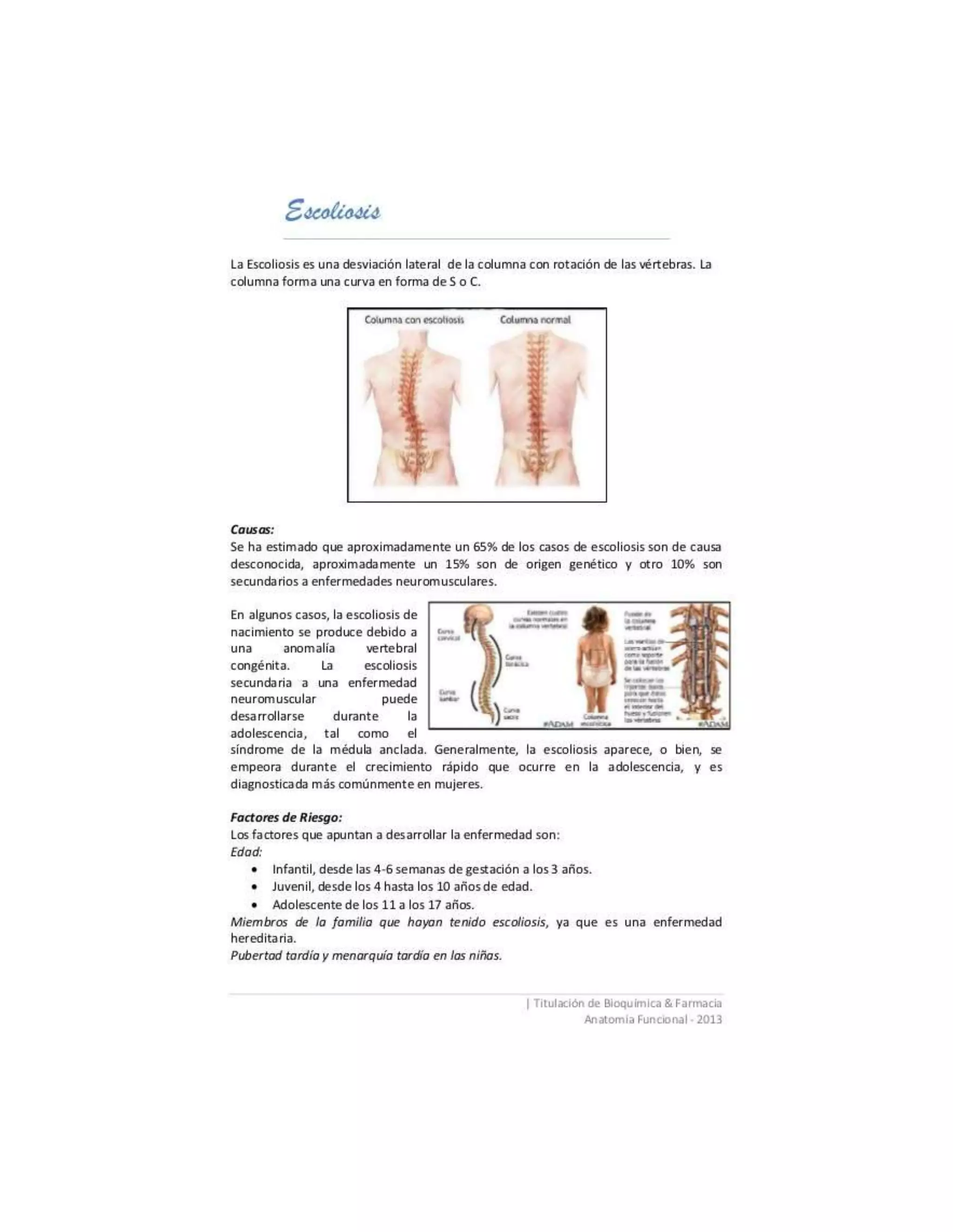 Cifosis, lordosis, escoliosis | DOCX