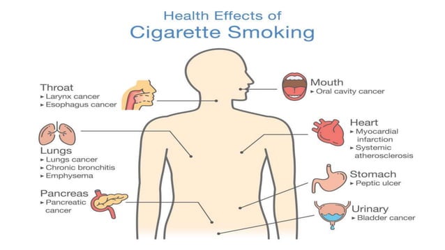 Cigarette smoking and its ill effects | PPTX
