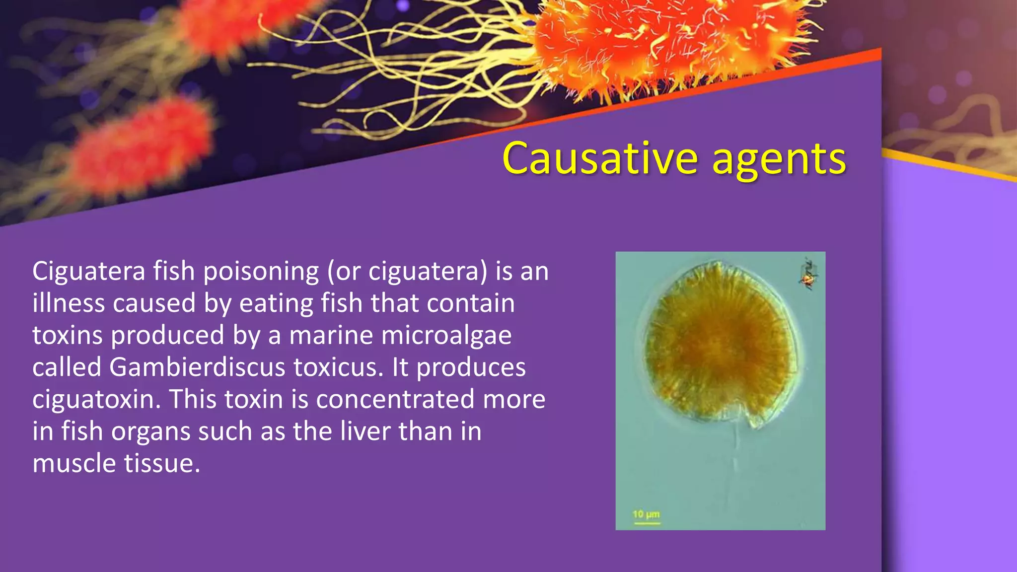 Ciguatera Poisoning.pptx