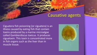Ciguatera Poisoning.pptx