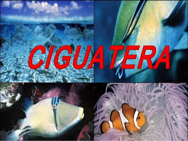 Ciguatera
