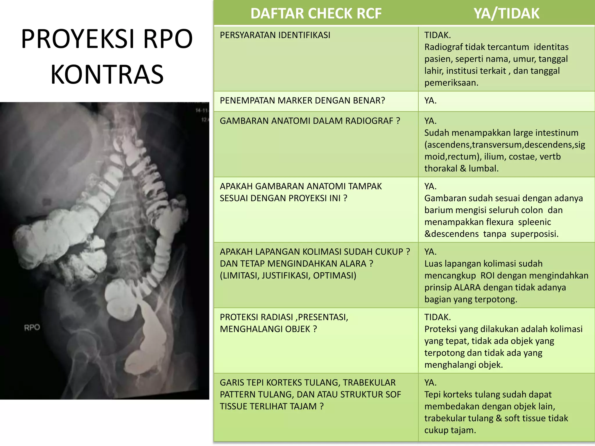 ppt kritisi dan evaluasi radiograf colon in loop | PPTX