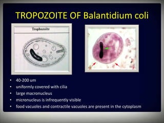 Ciliated protozoa | PPT