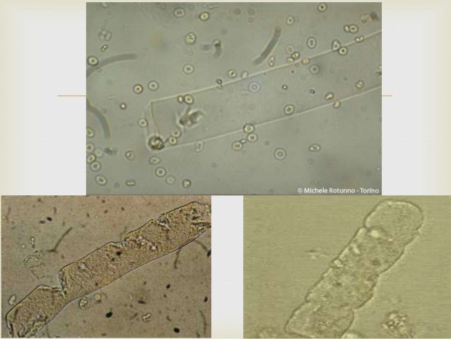 Cilindros Urinarios. Clase de Lic. Wilfredo Garcia