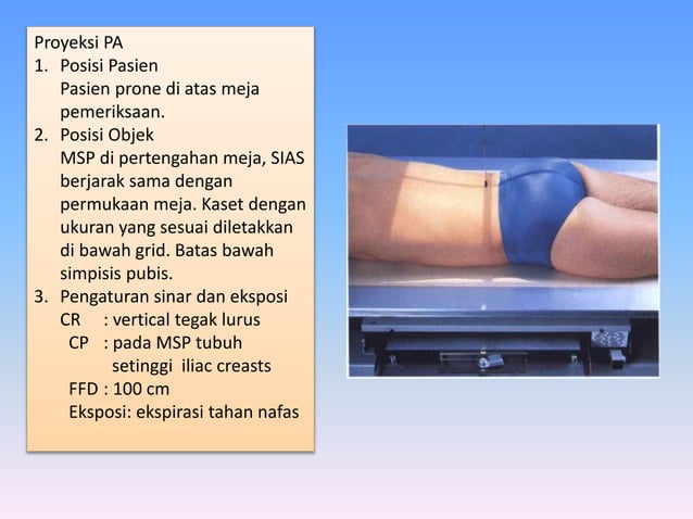 Teknik Pemeriksaan Radiografi Colon In Loop (CIL) | PPTX