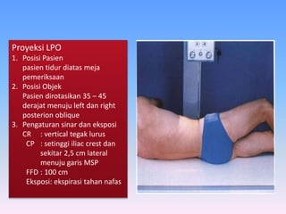 Teknik Pemeriksaan Radiografi Colon In Loop (CIL) | PPTX