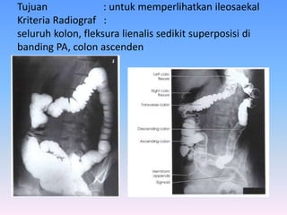 Teknik Pemeriksaan Radiografi Colon In Loop (CIL) | PPTX