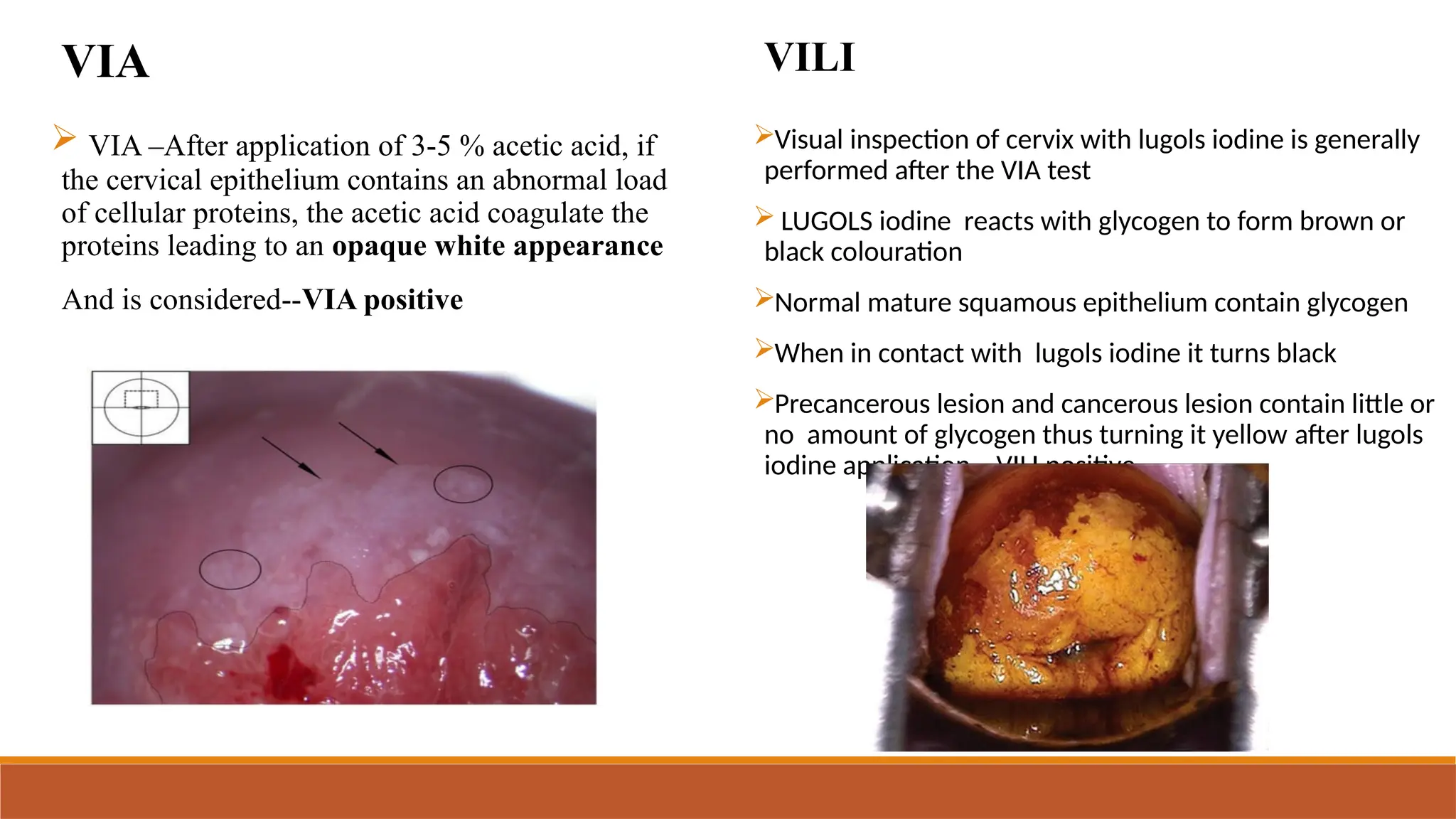 Premalingnant lesions of the cervix, CIN | PPTX