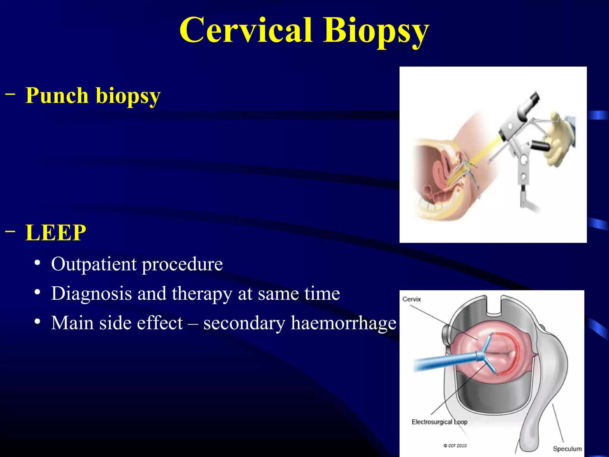 Cin&cancer cervix undergraduate | PPT