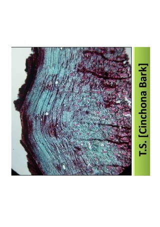 Cinchona Bark Microscopy