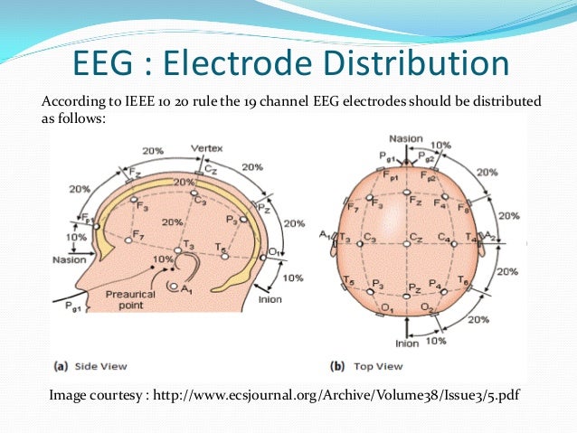 Eeg Based Motor Imagery Classification Using Svm And Mlp 