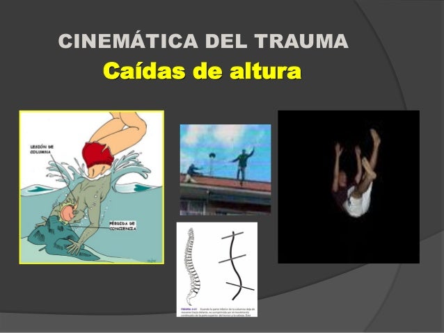 Cinematica Del Trauma Cinematica Del Trauma