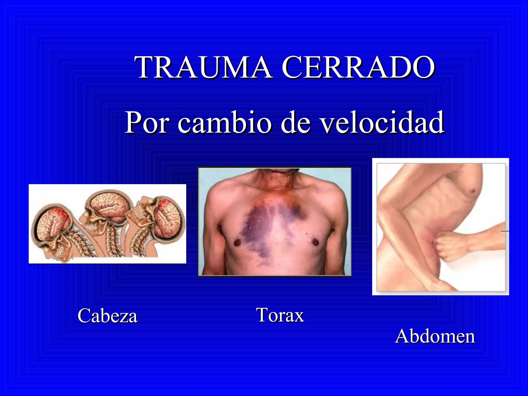 Cinematica del trauma | PPT