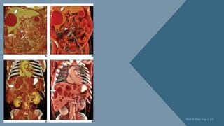 Cinematic rendering (2).pptx