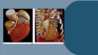 Cinematic rendering (2).pptx