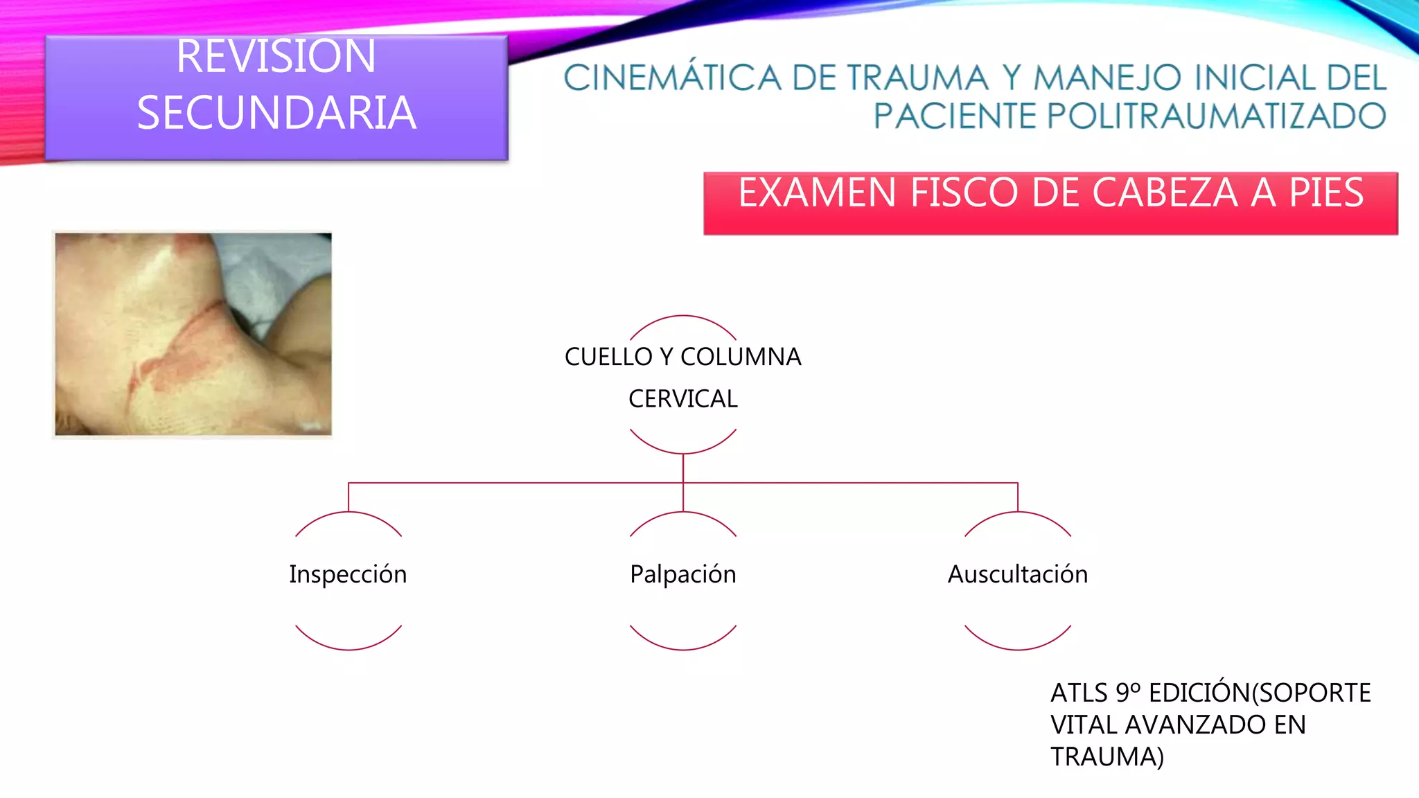 Cinemática de trauma y manejo inicial del paciente politraumatizado | PPTX