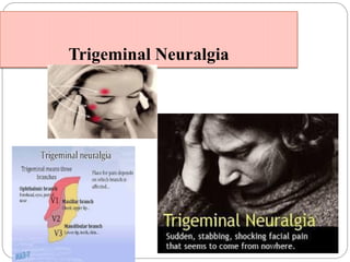 Cinical Anatomy of Face for anatomy studies.pdf