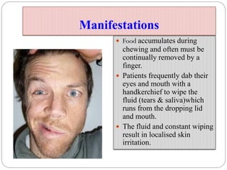 Cinical Anatomy of Face for anatomy studies.pdf