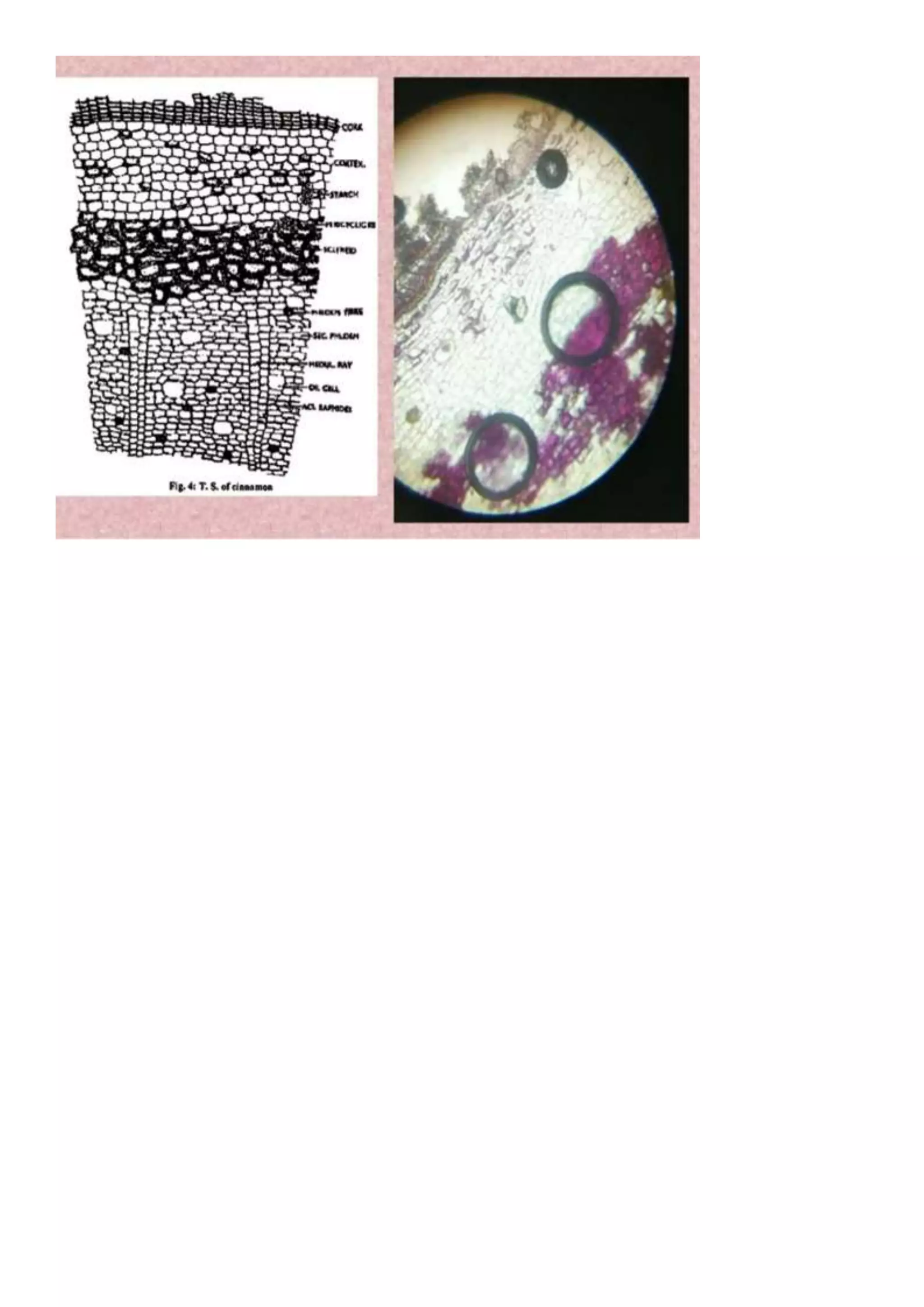 CINNAMON BARK microscopy.docx