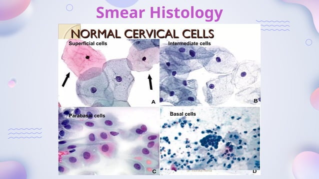 HPV, CIN, PAP SMEAR - description process guidelines etc | PPTX