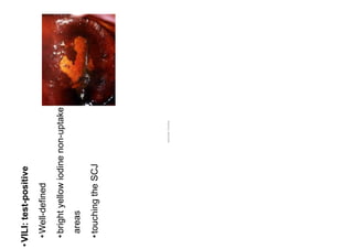 screening for cancer cervix | PDF