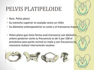 Cintura pelviana, (TIPOS DE PELVIS) | PPTX