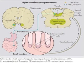 Chemotherapy induced Nausea and Vomiting (CINV) - Dhaval joshi | PPT