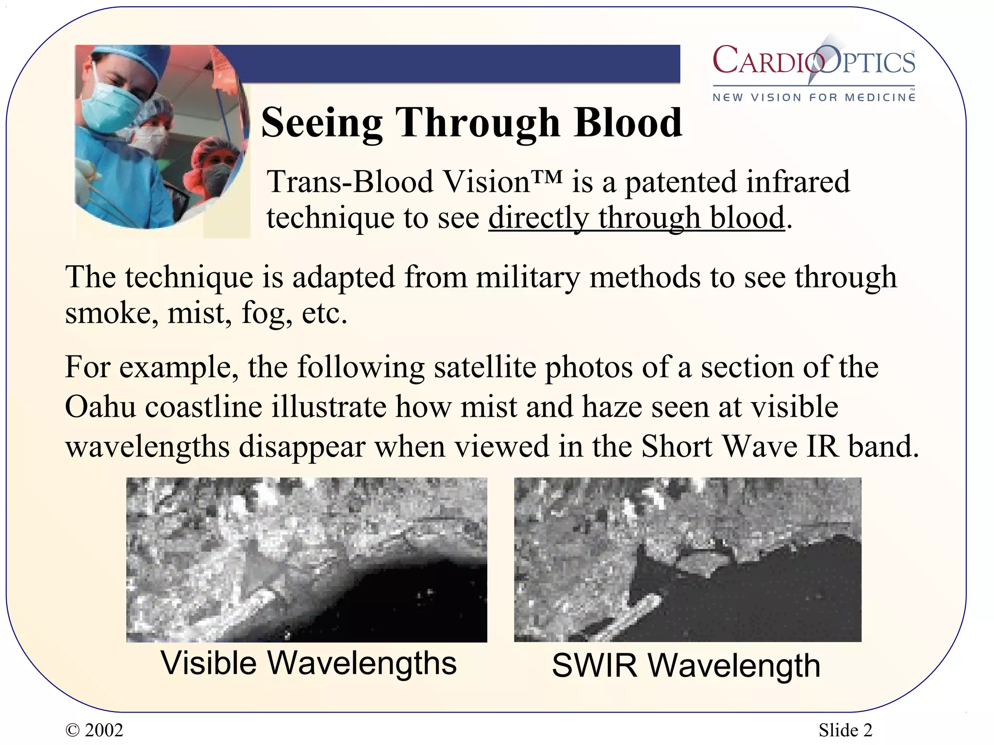 209 trans blood vision™ | PPT