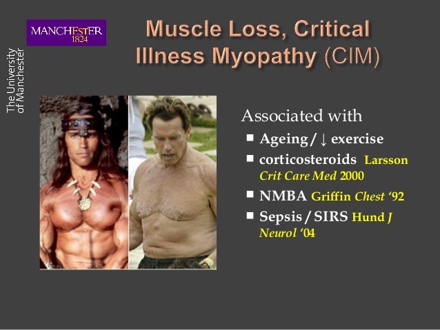 Critical Illness Polyneuropathy