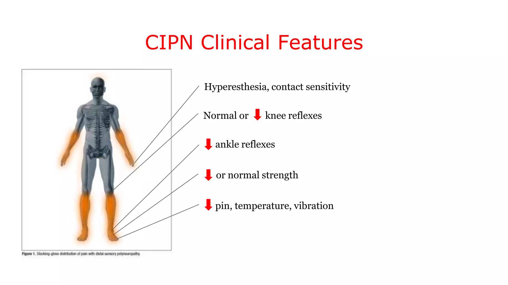 Chemotherapy Induced Peripheral Neuropathy (CIPN): A Song of Ice and ...