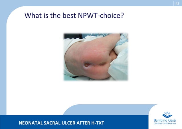 Ciprandi, closed incisional npwt | PDF