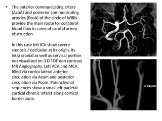 Circle of Willis and its clinical relevance | PPTX