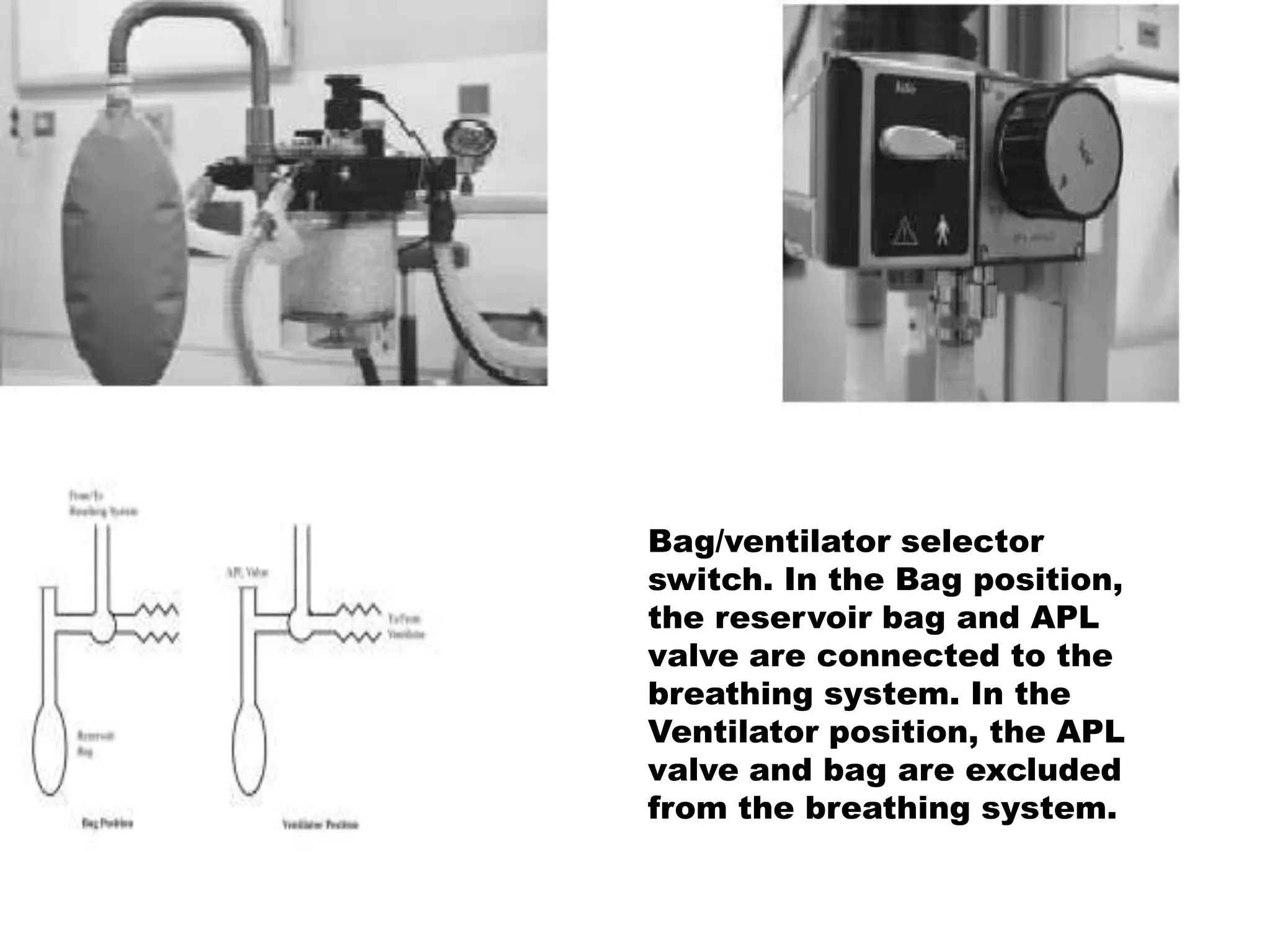 Circle system low flow anesthesia | PPTX
