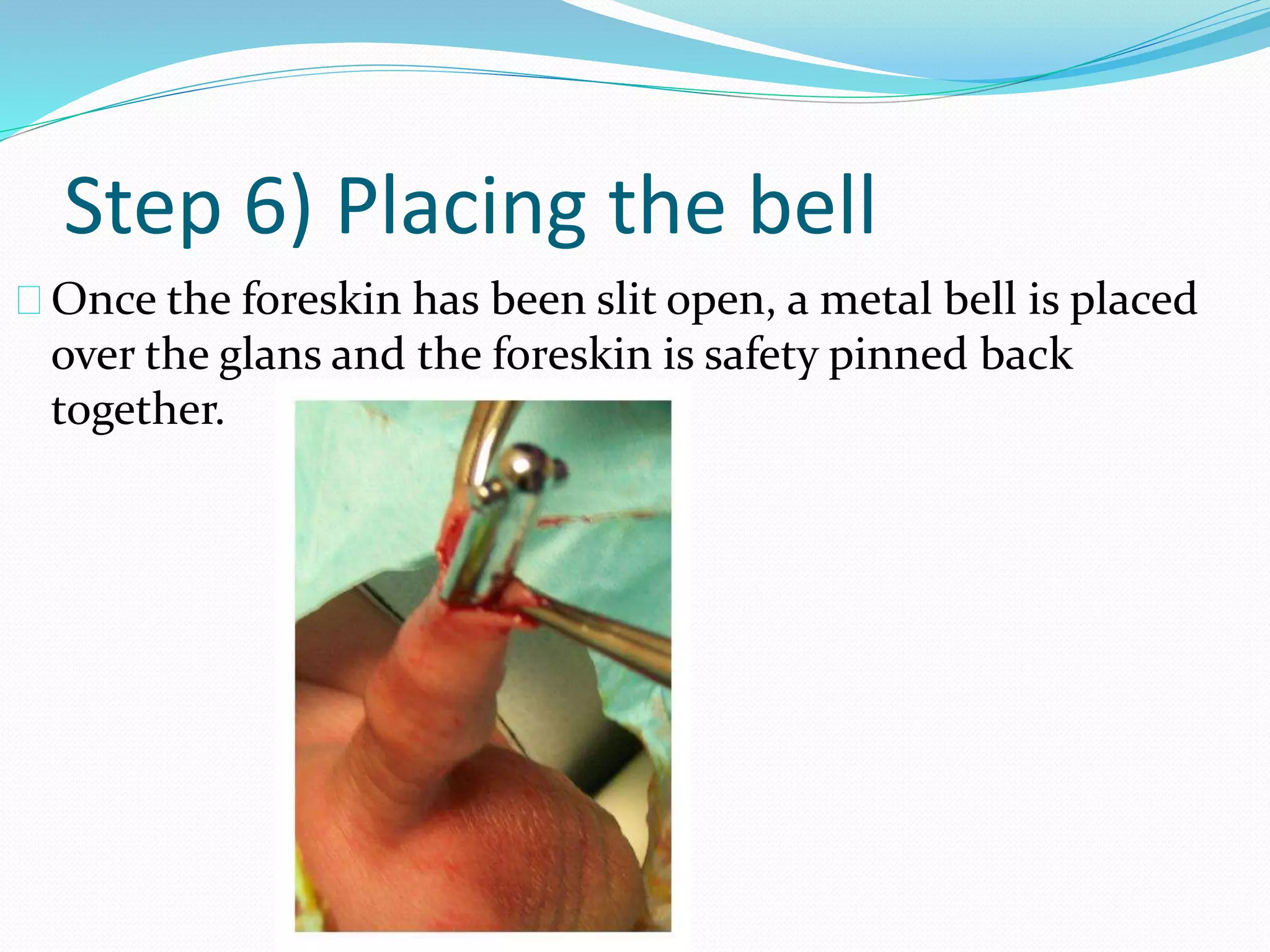 ***WARNING*** CIRCUMCISION HORROR. NSFW OR CHILDREN | PPTX